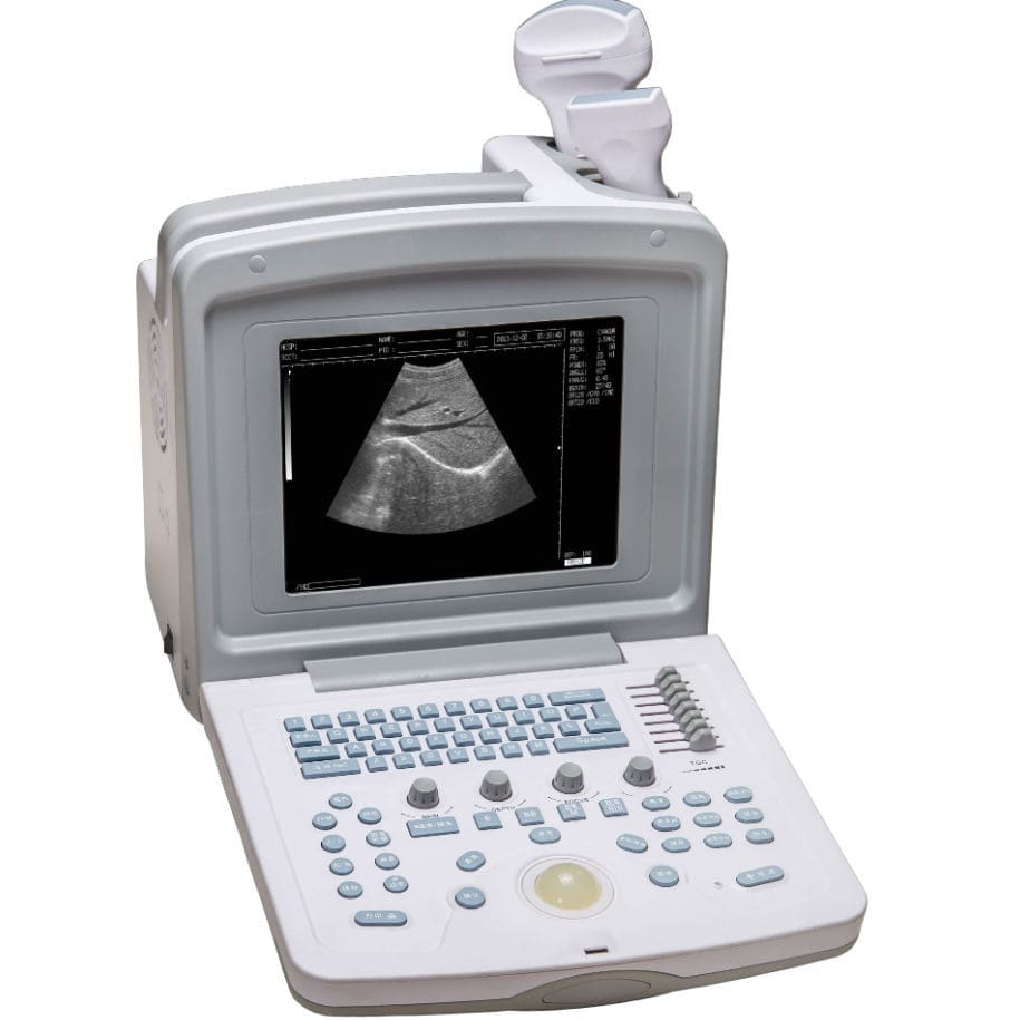 Portable ultrasound system - WED-180 - Shenzhen Well.D Medical ...