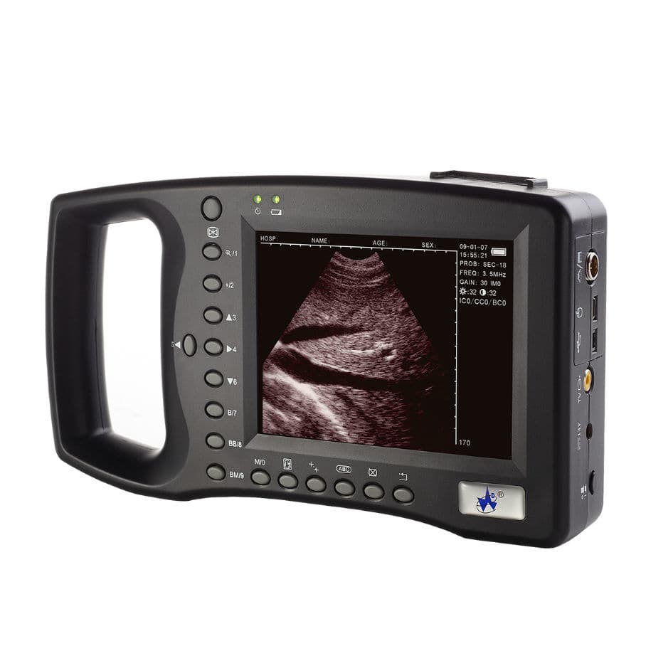 Hand-held ultrasound system - WED-2000A - Shenzhen Well.D Medical ...