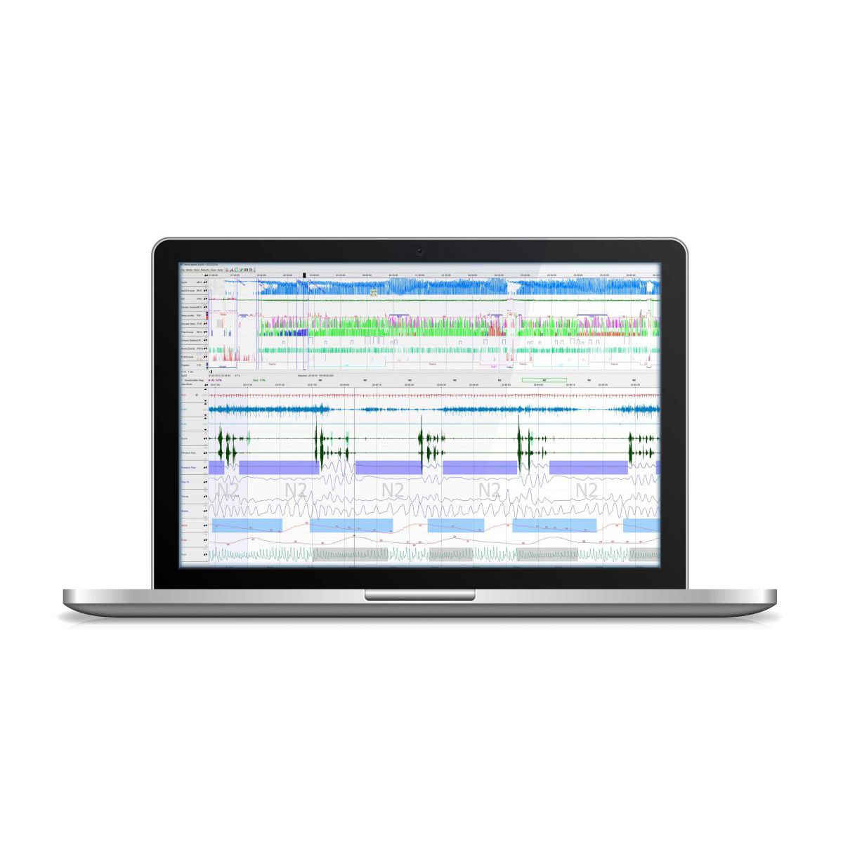 Sleep laboratory software - DOMINO - SOMNOmedics - reporting / analysis ...