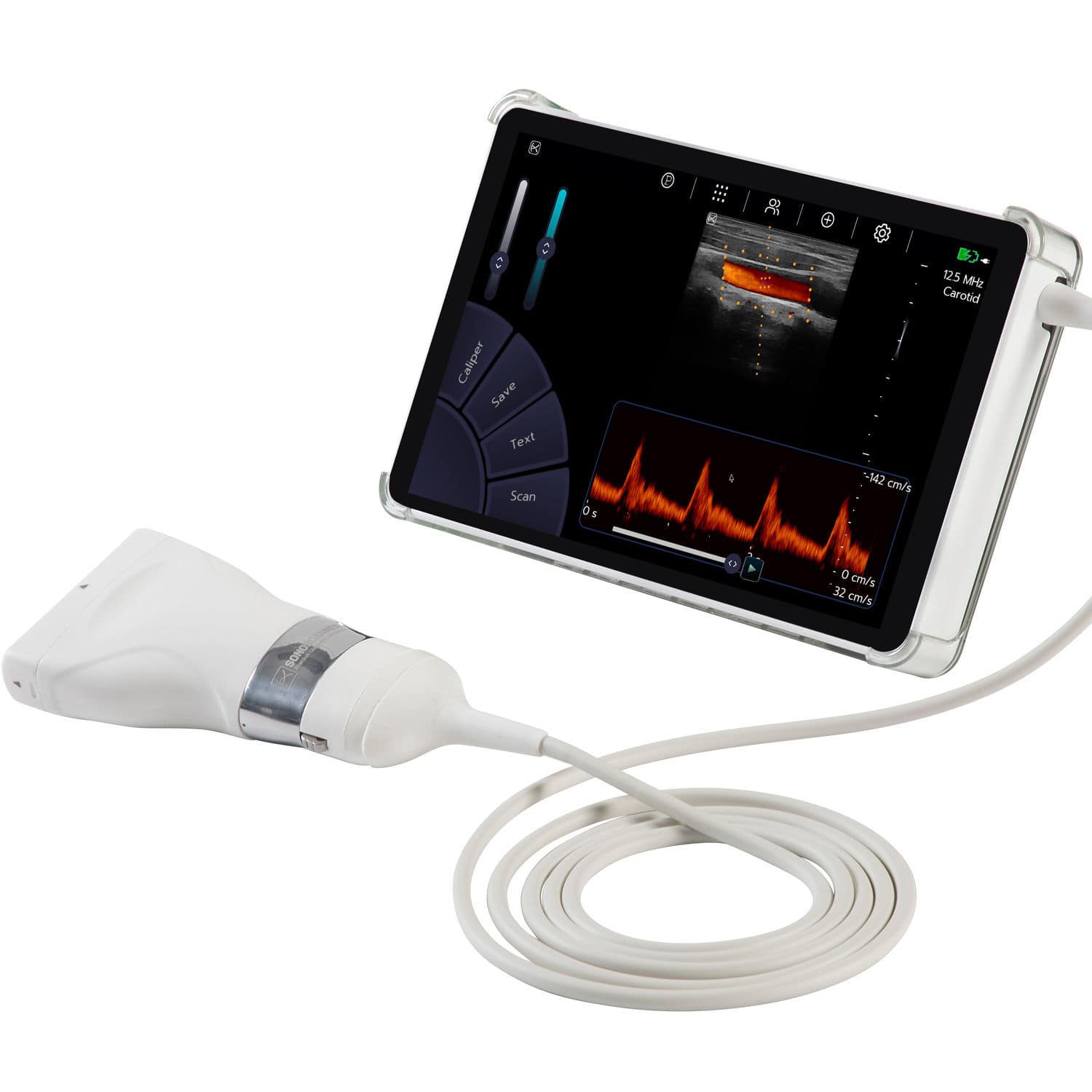 Hand-held ultrasound system - U-Lite PRO - Sonoscanner - for abdominal ...