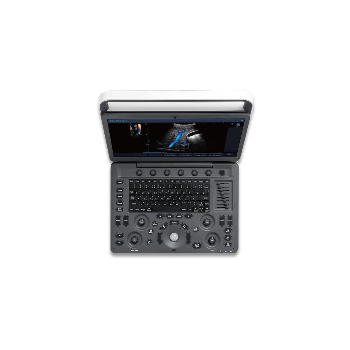 Portable ultrasound system - E2 - SonoScape - for multipurpose ...