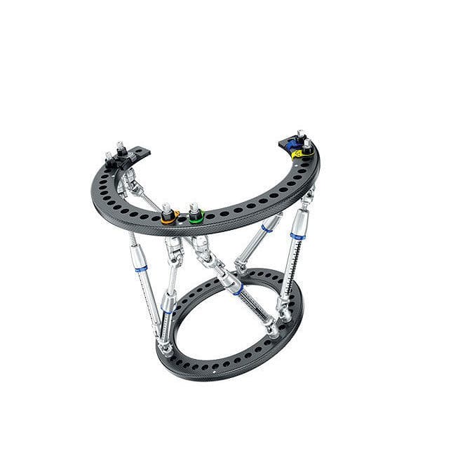 Ankle external fixation system - Hoffmann LRF Hexapod - Stryker ...