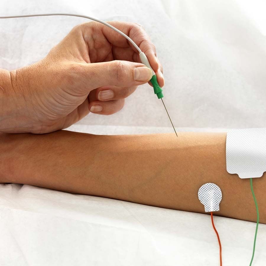 Reusable Emg Electrodes at Gail Gaskell blog