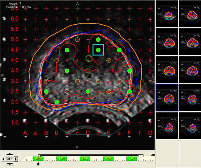 Visualization software - VariSeed™ - Varian Oncology - treatment ...