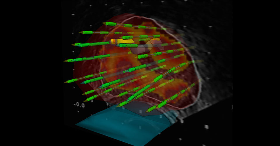 Visualization software - VariSeed™ - Varian Oncology - planning ...