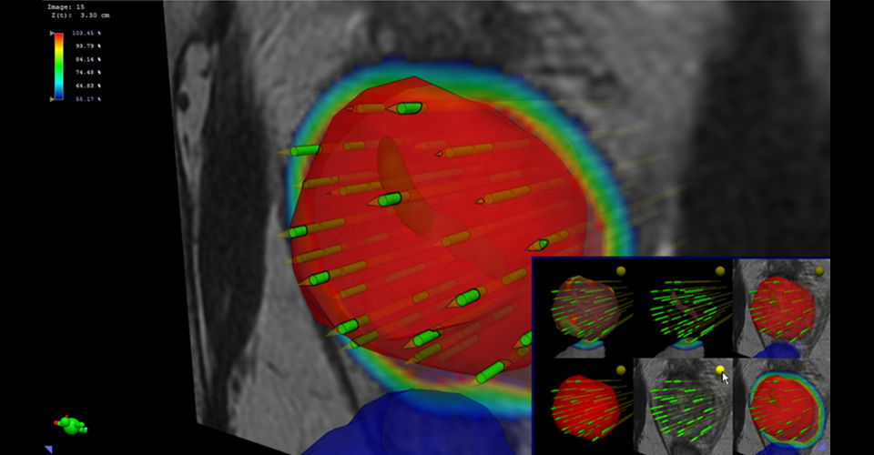 Visualization software - VariSeed™ - Varian Oncology - planning ...