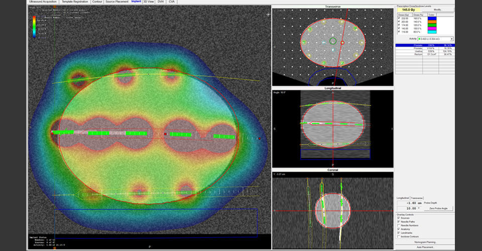 Visualization software - VariSeed™ - Varian Oncology - planning ...