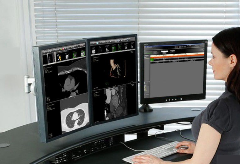 Diagnostic computer workstation - Voyager Imaging - medical imaging