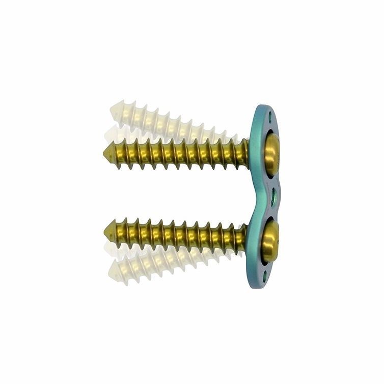 Epiphysis compression plate - Double Medical Technology - ankle ...