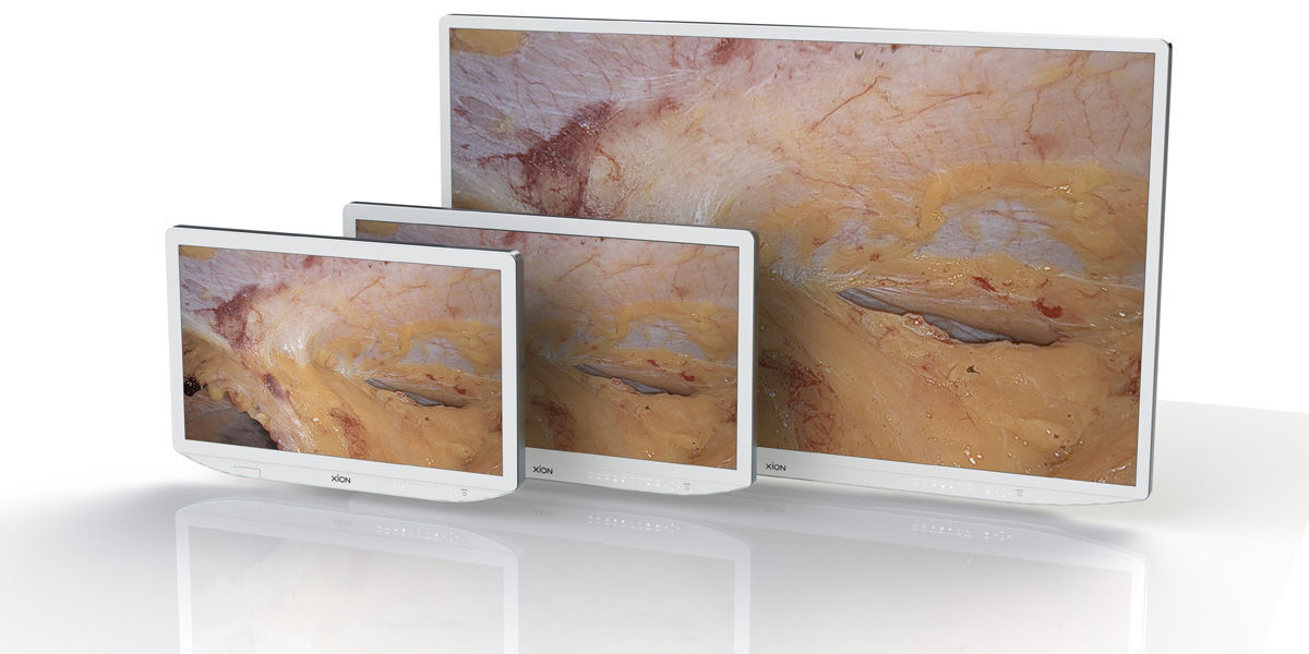 Surgical monitor - XION medical - 32" / 27" / 23.8"