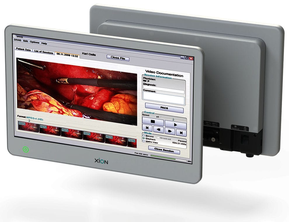Diagnostic display - XION medical - endoscopy / surgical / 21.5"