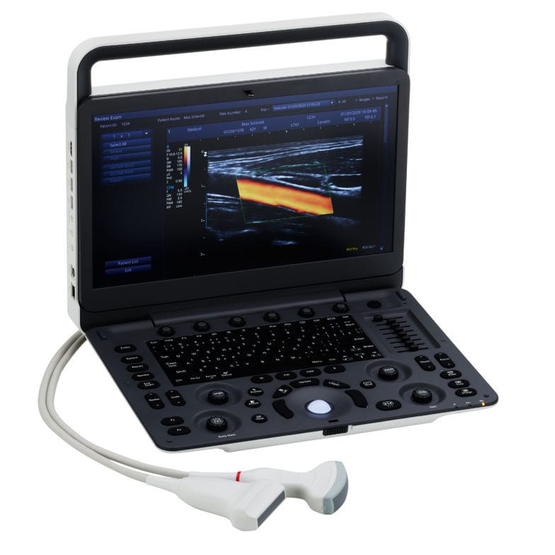 Portable ultrasound system - SonidoSmart Pro - Zimmer MedizinSysteme ...