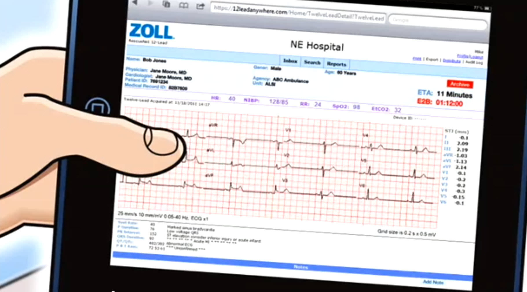 Medical software - RescueNet® 12-Lead - ZOLL Medical Corporation ...