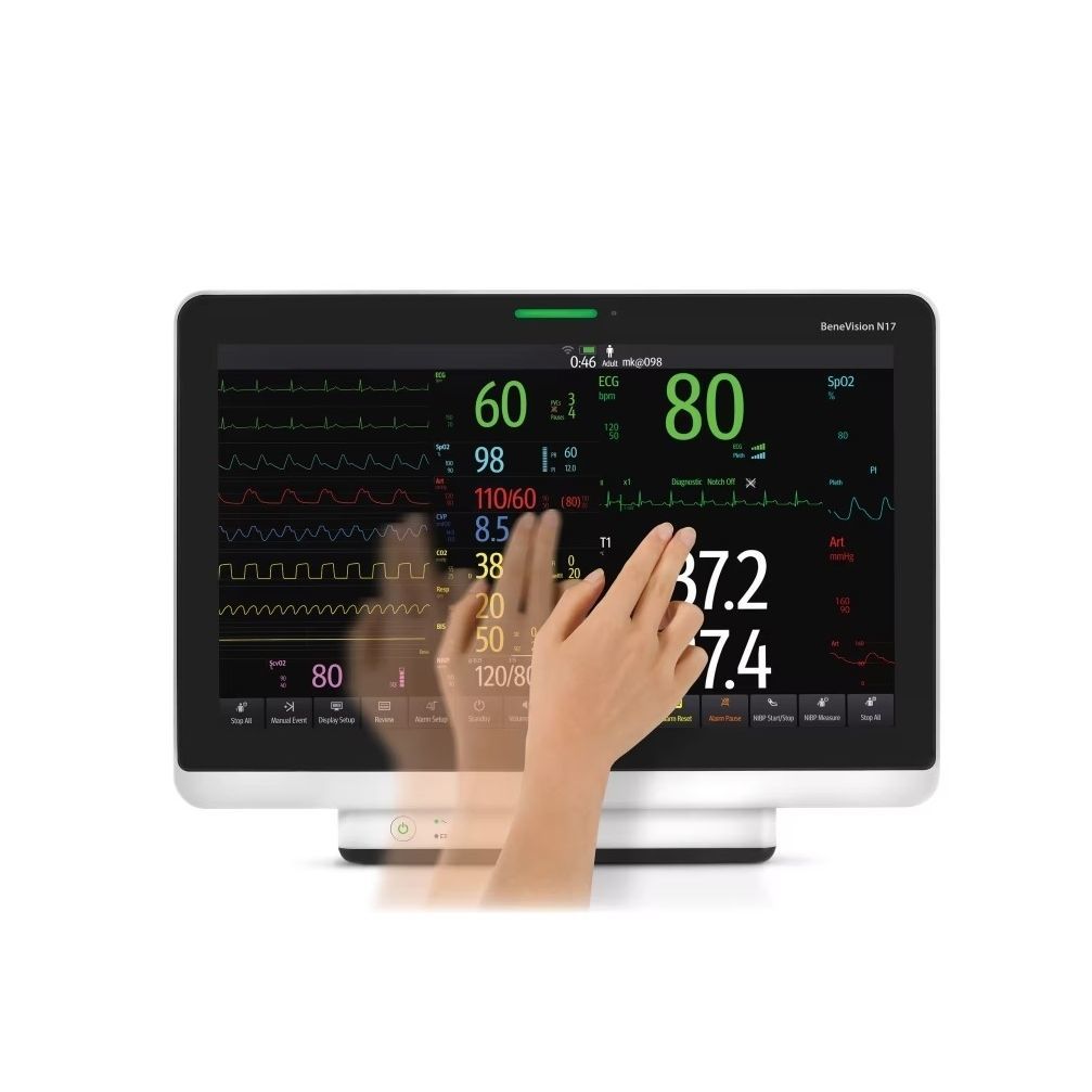 Modular patient monitor - BeneVision™ N17/N15/N12 - Mindray North ...