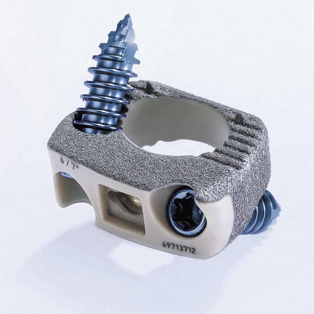 Cervical interbody fusion cage - ArcadiusXP C® - Aesculap® - anterior