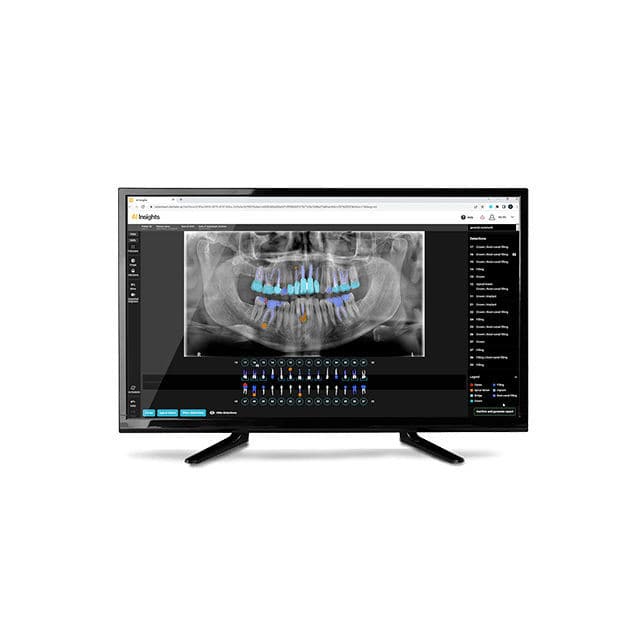 Dental AI platform - Carestream Dental - document management ...