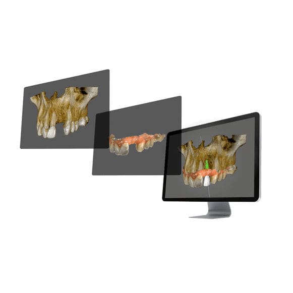 Planning software module - PDIP - Carestream Dental - for dental ...