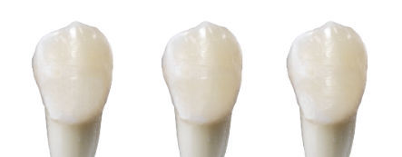 Flowable composite dental material - Ceram.x Spectra ST flow - Dentsply ...