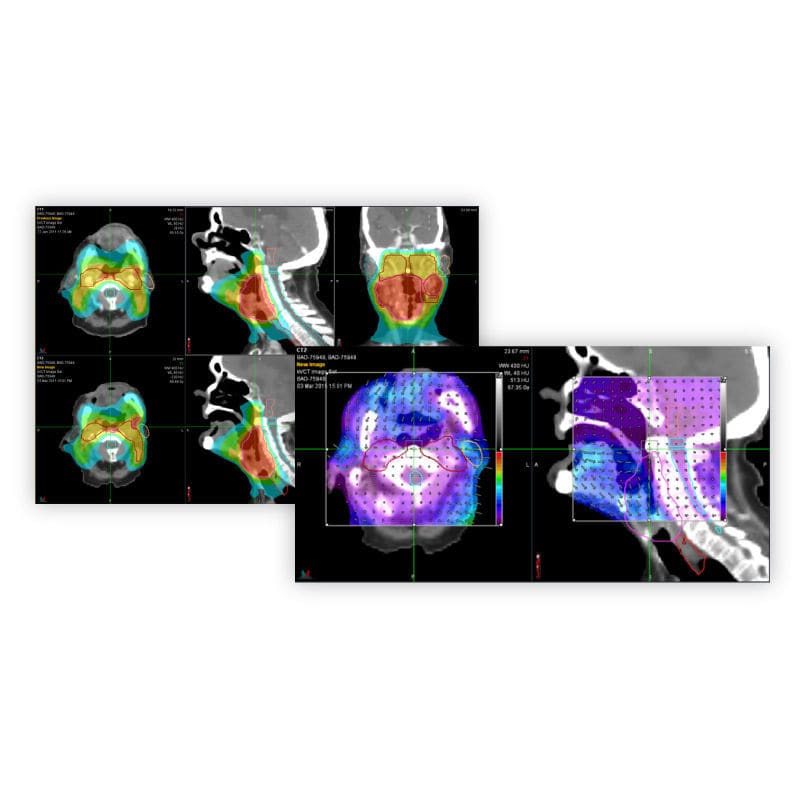 Treatment planning software - PreciseRTX® - Accuray - CT / radiation ...
