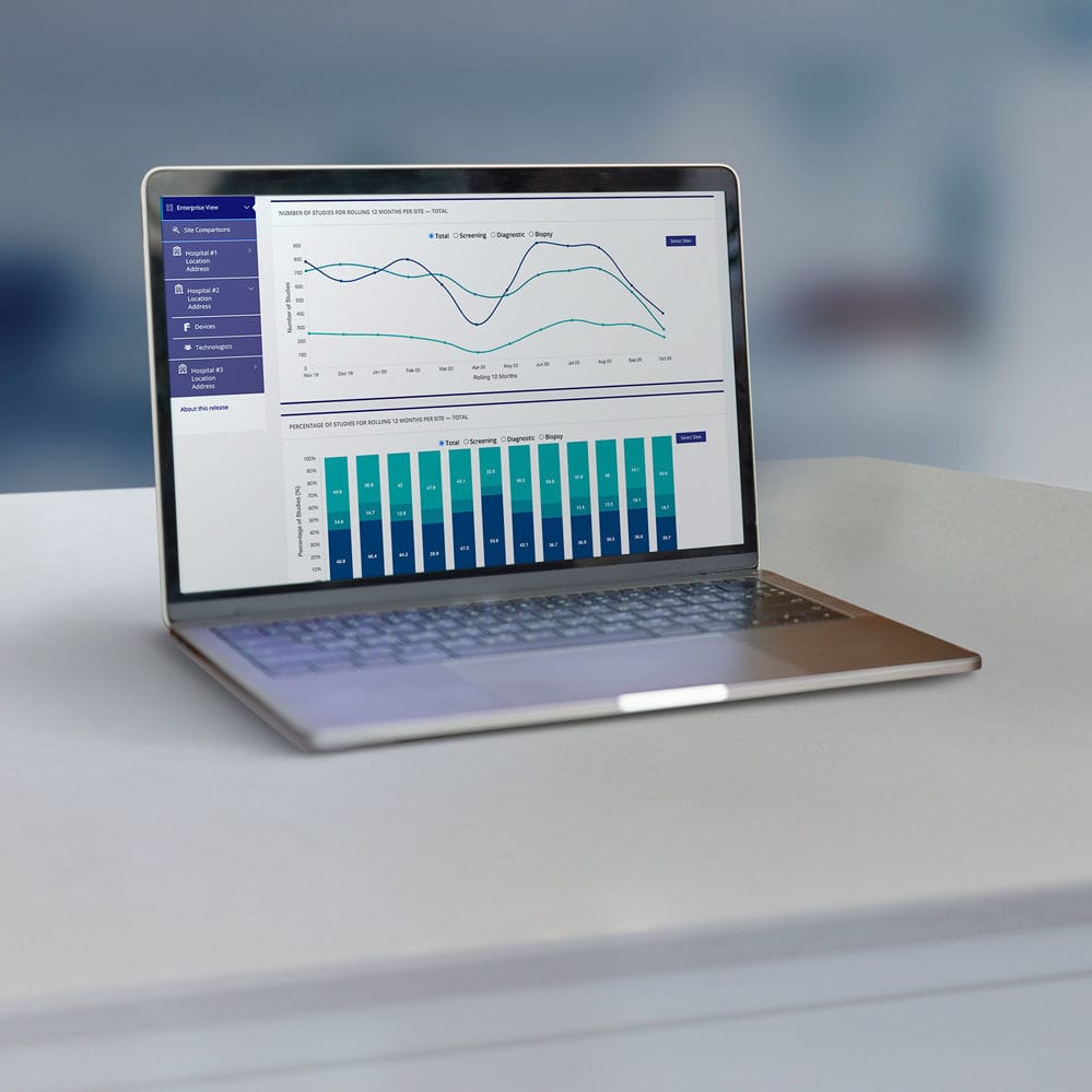 Analysis software - Unifi™ - Hologic - diagnostic / screening / for mapping