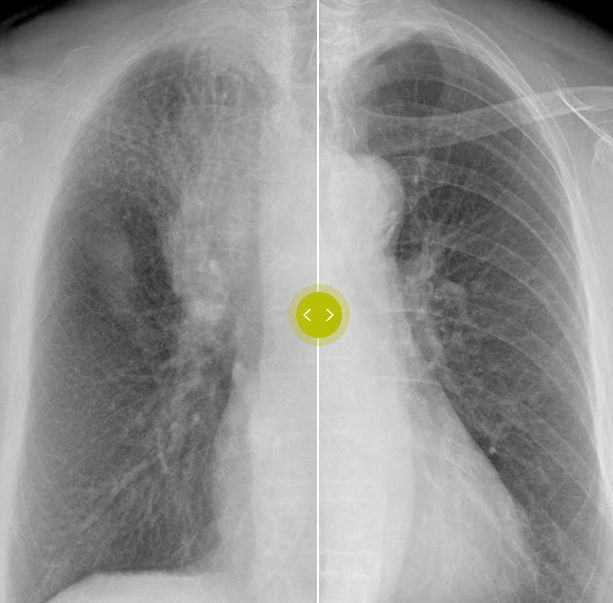 Image enhancement software - Philips Healthcare - medical / radiography ...