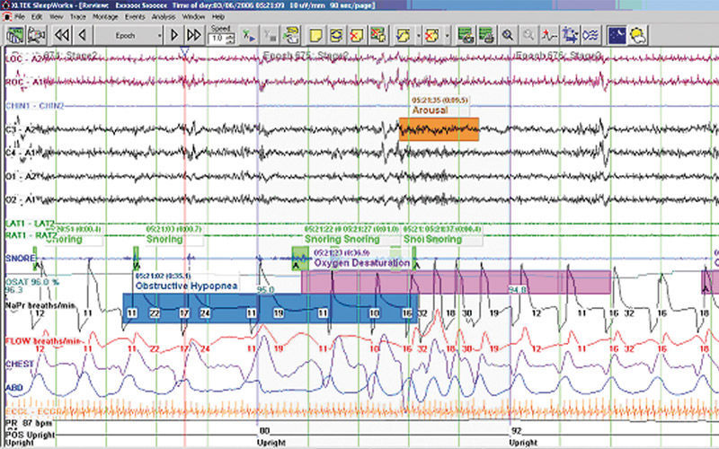 Medical software - SleepWorks™ - Natus Hearing & Balance - laboratory / analysis / management