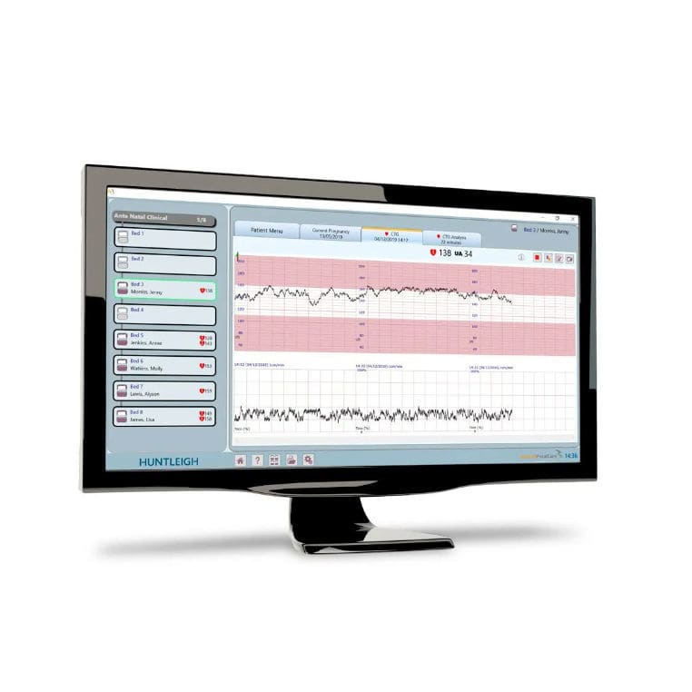 Analysis software - Sonicaid Dawes-Redman CTG Analysis™ - Huntleigh ...
