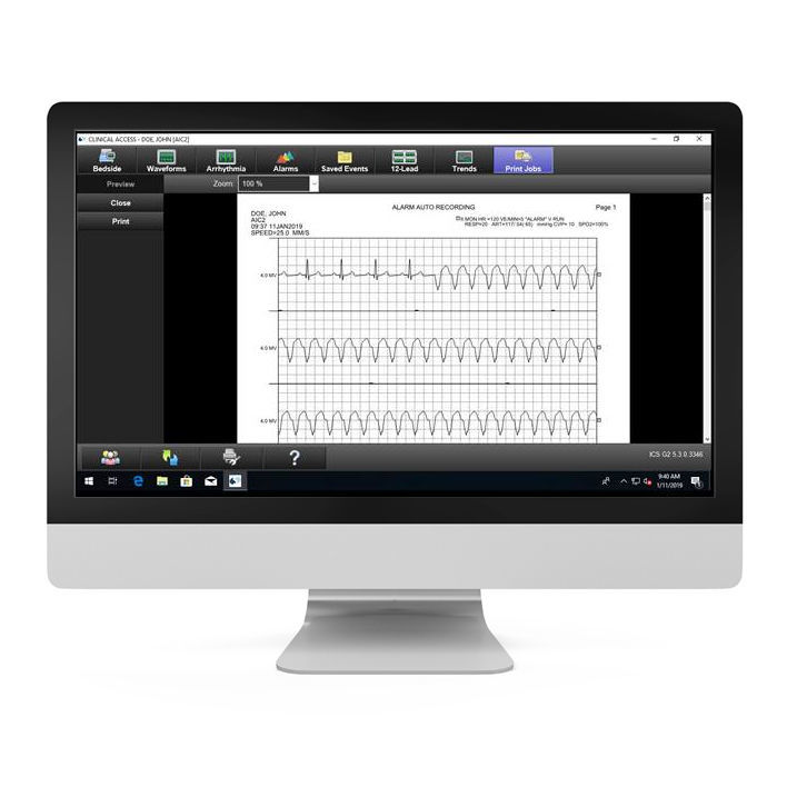 Print management software module - Spacelabs Healthcare - clinical ...