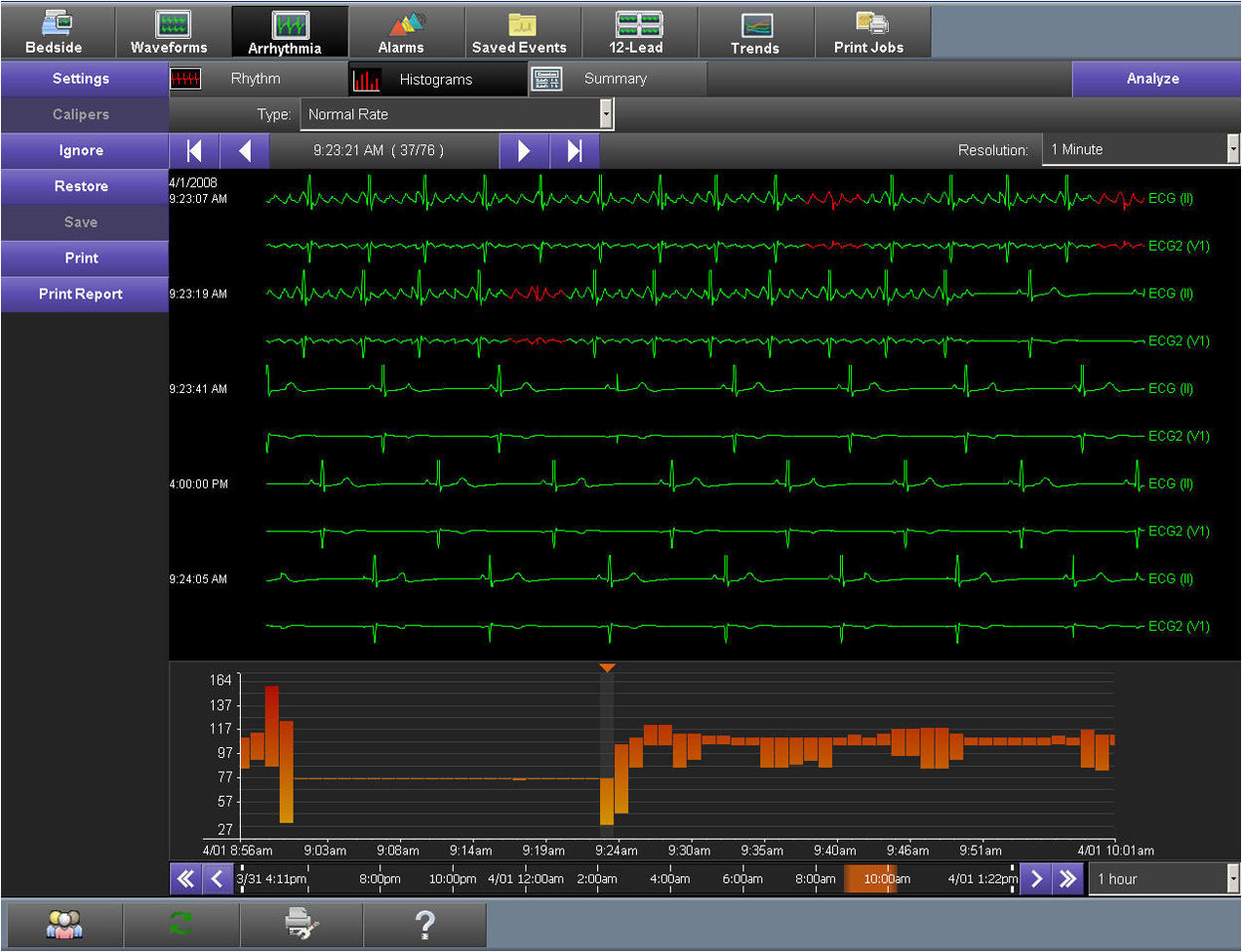 Visualization software - Smart Disclosure - Spacelabs Healthcare ...