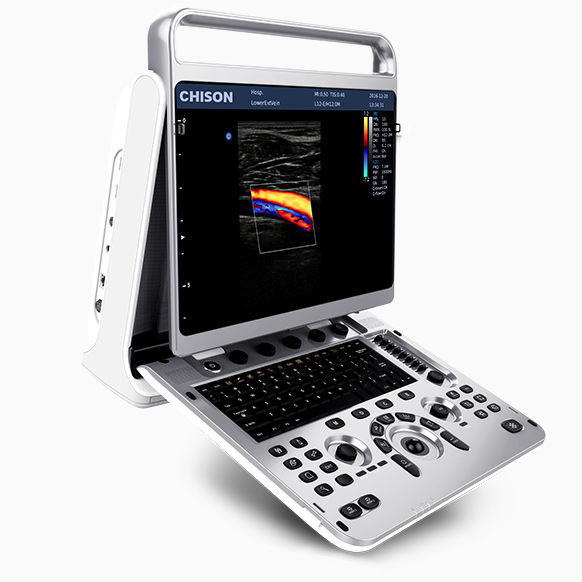 Portable ultrasound system - EBit 20 - CHISON Medical Technologies ...
