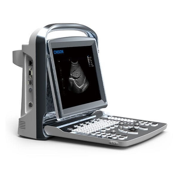 Portable ultrasound system - ECO 1 - CHISON Medical Technologies - for ...
