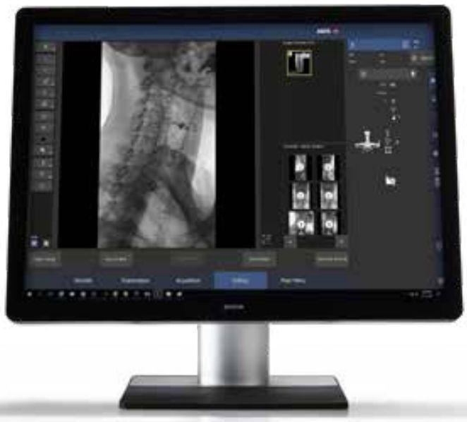 Image analysis software - MUSICA™ - AGFA - management / diagnostic / EMR