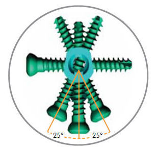 Humerus intramedullary nail - TRIGEN™ - Smith & Nephew - proximal