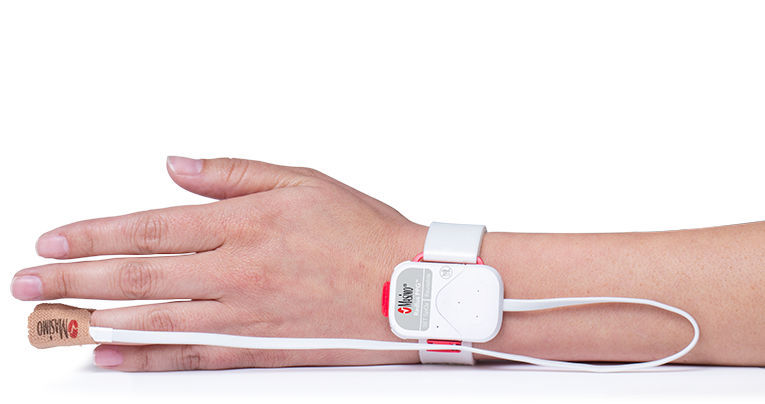 Fingertip pulse oximeter - Radius PPG™ - Masimo