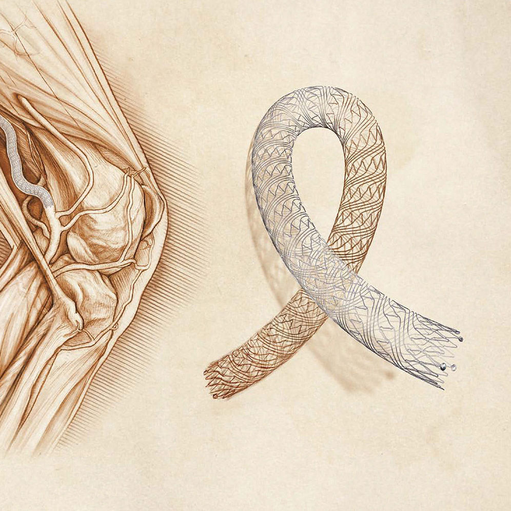 Peripheral stent - S.M.A.R.T™ Flex - Cordis - nitinol / self-expanding