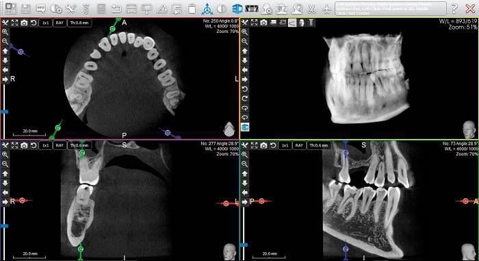 Panoramic X-ray system / dental CBCT scanner / cephalometric X-ray ...