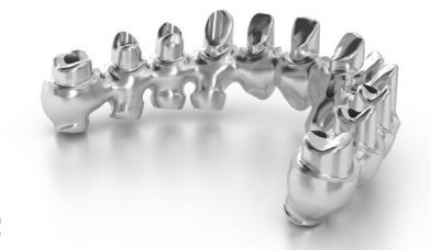 Dental bridge - ANTHOGYR