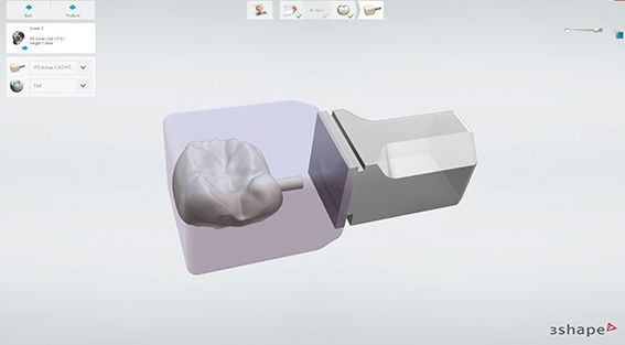 Treatment software - 3Shape TRIOS Design Studio - 3shape - design ...