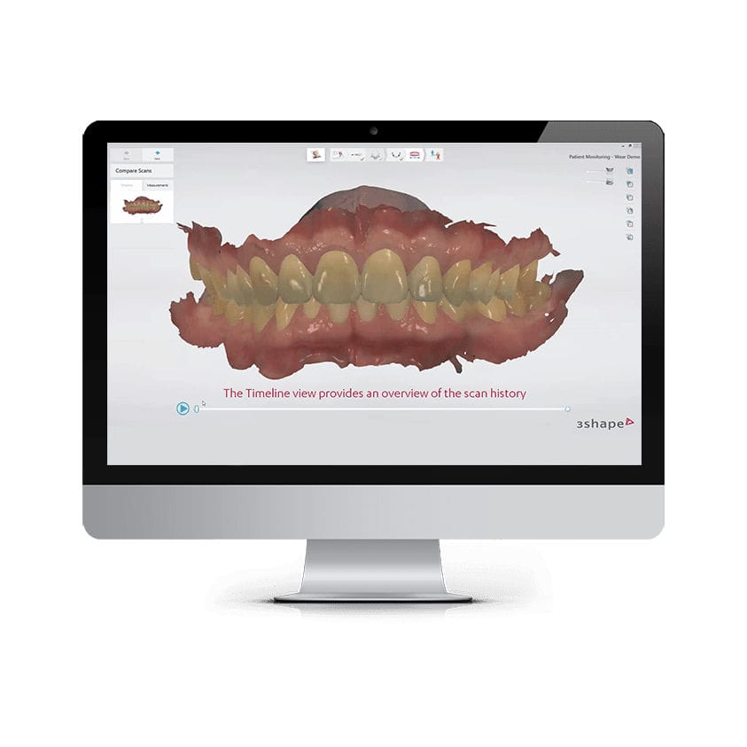 Monitoring software - 3shape - diagnostic / treatment / scan