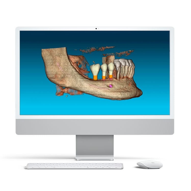 Visualization software - BTI Scan 4 - BTI Biotechnology Institute ...