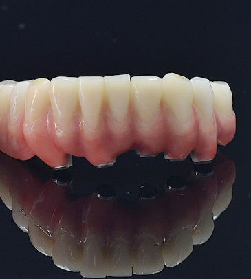 PEEK dental material - Pekkton® ivory - Cendres+Métaux SA - for dental ...