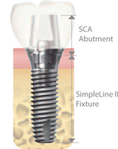 Tapered dental implant / titanium / internal octagon / self-tapping ...