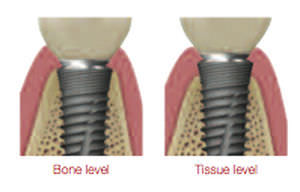 Tapered dental implant - NR Line - Dentium - titanium / internal ...