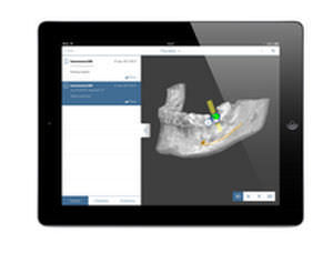 Dental implant simulation software / planning / for dental implantology ...