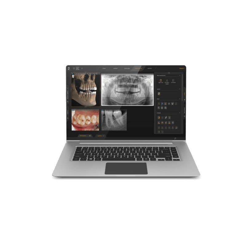 Acquisition software - Sidexis 4 - DENTSPLY MAILLEFER - treatment ...