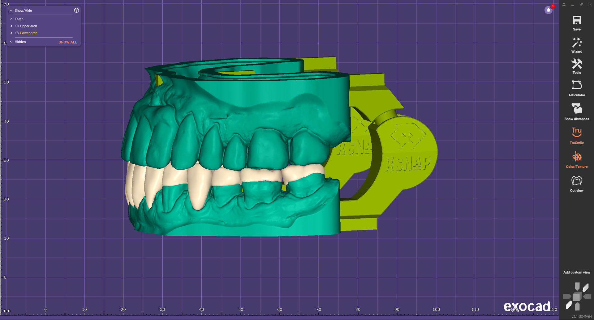 CAD software module - xSNAP - exocad GmbH - printing / dental / joint