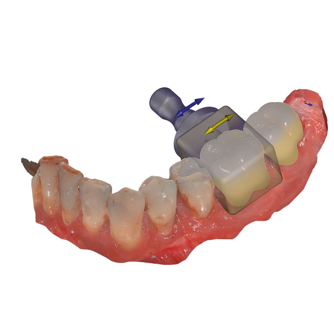 Design software module - In-CAD Nesting - exocad GmbH - CAD / printing ...
