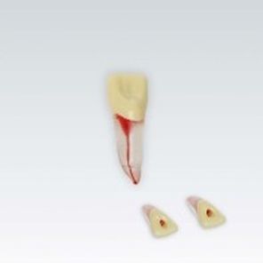 Tooth model - ANA-4 ZPUKN 21 - frasaco - root canal / dental care ...