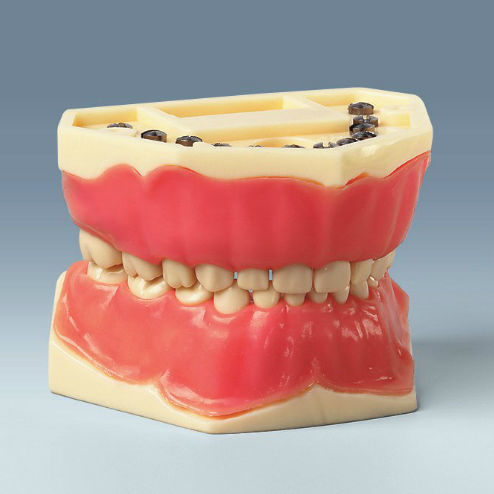 Denture model - AK-6/2 - frasaco - for teaching / child