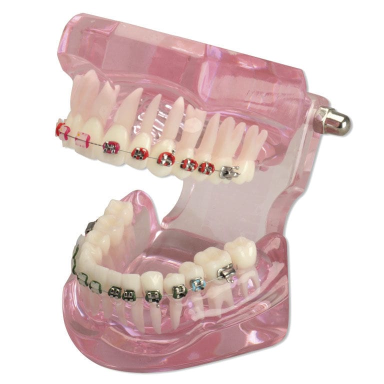 Denture model - 355645 - Hager & Werken - for orthodontics / for ...